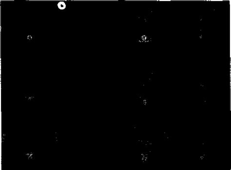 Figure 3 From Reduction Of Truncation Artifacts In Fan Beam Transmission Imaging Using A