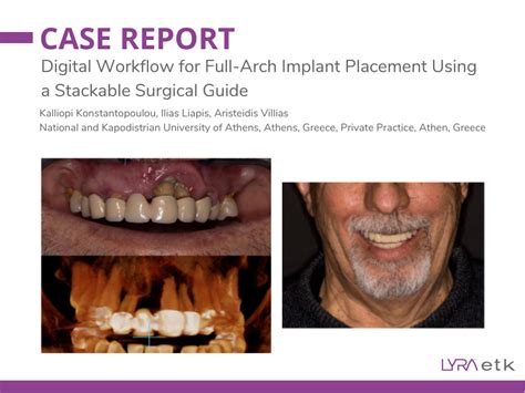 Digital Workflow For Full Arch Implant Placement Lyra Etk