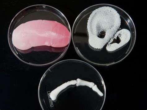 Patenting 3d Printed Organs Guardian Liberty Voice