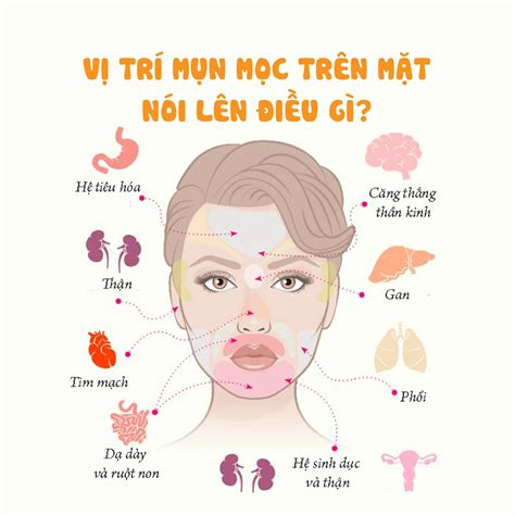 VỊ TrÍ MỤn MỌc TrÊn MẶt CỦa BẠn NÓi LÊn ĐiỀu GÌ