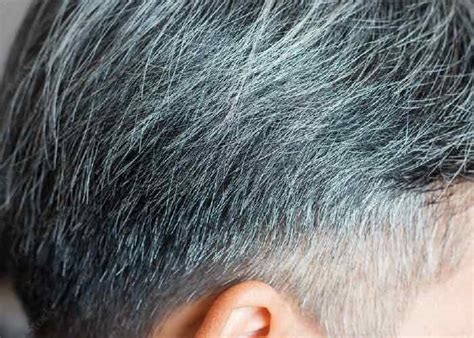 ผมหงอก เกิดจากอะไร ผมหงอกก่อนวัย ขาดวิตามินอะไรหรือเปล่า