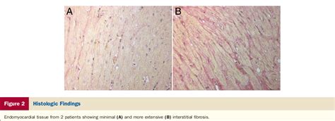 Figure 2 From Evaluation Of Diffuse Myocardial Fibrosis In Heart Failure With Cardiac Magnetic