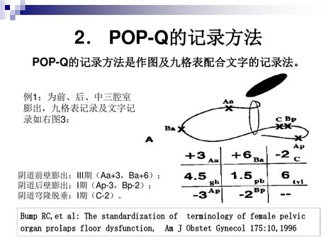 如何应用和评价POP Q评估体系PPT课件 word文档在线阅读与下载 无忧文档