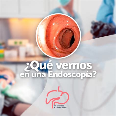 En Una Endoscopia Superior O Esófago Gastro Duodenoscopia Egd Vemos
