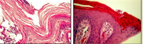 Integument Lab Flashcards Quizlet