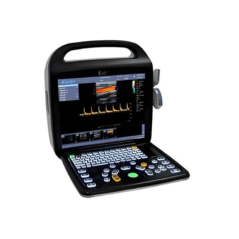 휴대용 초음파 기기 이동이 간편한 의료용 B 초음파 장비 진단 및 검사에 최적화