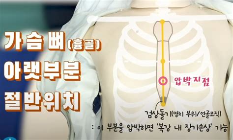 심폐소생술 가슴압박 위치 횟수 순서 Cpr 방법