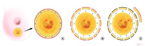 Methods Of Intraoperative Circumferential Frozen Section Analysis Of Download Scientific