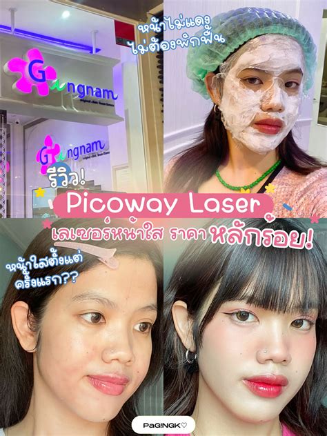 รีวิวทำ Pico Plus Laser ทดลองครั้งแรก 1900 บาท ดีจริงไหม แกลเลอรีที่โพสต์โดย ม๋ามายด์ 🥨🐶 Lemon8