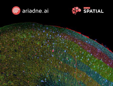 Spatialbiology Neurodegeneration Dataanalysis Innovation… Dr Lucas Schütz