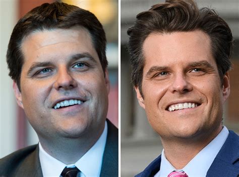 10 “mar A Lago” Face Transformations That Left People Utterly Stunned