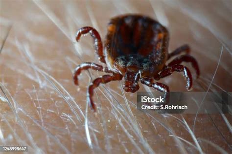 인간의 피부에 기어 다니는 기생 성 피부 의 매크로 클로즈업 화려한 암소 진드기 화려한 개 진드기 초원 진드기 및 습지