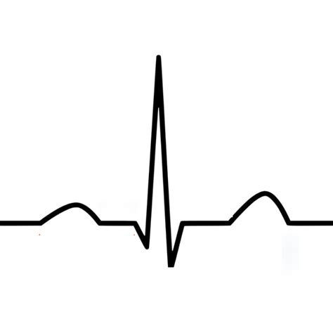 Ecg Diagram Quizlet