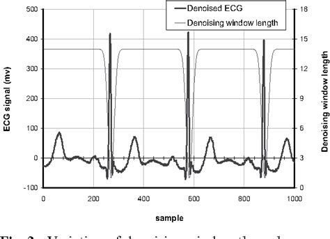 Figure 2 From A Mathematical Algorithm For Ecg Signal Denoising Using