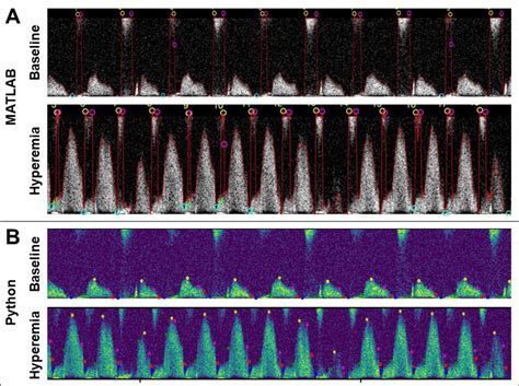 Images Displaying The Removal Of Top Noise From Analysis In The Updated