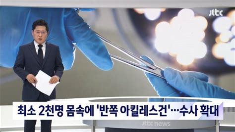 지난 7년간 십자인대 수술 받은 사람 중 무허가 인대 이식 받은 사람 최소 2천명 인스티즈 Instiz 이슈 카테고리