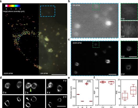 Reliable Interpretation Of Late Endosomes Locomotion Requires 3d Sr Download Scientific