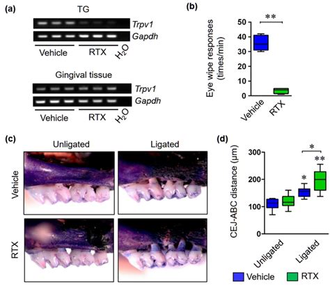 Neuronal Trpv1 Activation Regulates Alveolar Bone Resorption By Suppressing Osteoclastogenesis