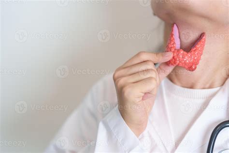 Doctor With Human Thyroid Anatomy Model Hyperthyroidism