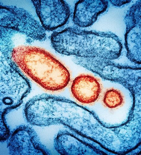 Nipah Outbreak In India Grows To 6 Cases Cidrap