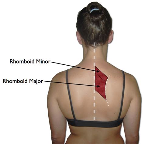 Rhomboid Trigger Points A Pain Between The Shoulder Blades TriggerPointTherapist Com