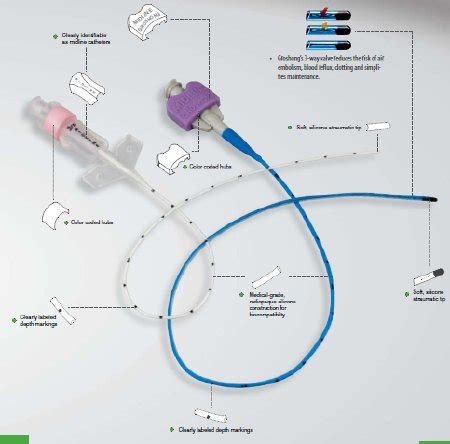 Groshong Catheter