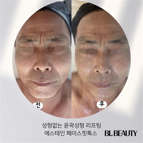 잠실눈썹문신 잠실반영구 잠실속눈썹 • 인스타광고 전문 • 아이써치마케팅 리그램 Blbeautyacademy 비엘뷰티는 최고의 제품과 기술력으로 임상