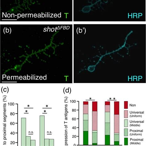 F Actin Binding Domain Of Shot Is Required For Proximal Localization Of Download Scientific
