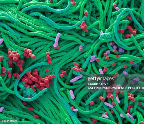 Skin Sem Photos And Premium High Res Pictures Getty Images