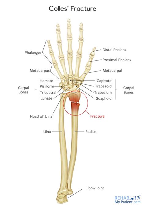 Proximal Ulna And Distal Radius Quiz My Xxx Hot Girl