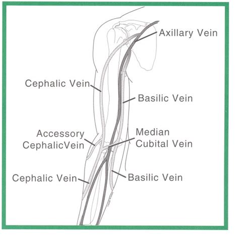 PICC Lines Chelsea And Westminster Hospital NHS Foundation Trust