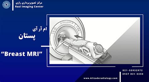 ام آر آی پستان چیست؟ Mri سینه در بهترین مرکز تصویربرداری تهران