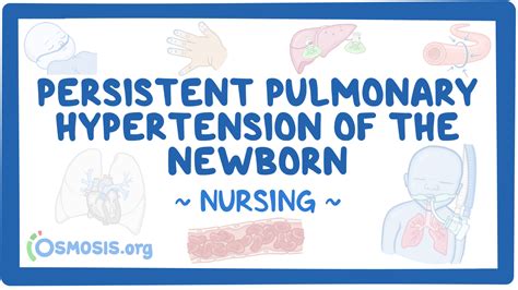 Persistent Pulmonary Hypertension Of The Newborn Pphn Nursing Video