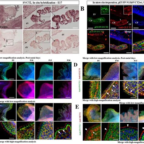 Choroid Plexus Explants Maintain Epithelial Cell Polarization A