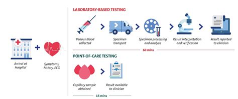 Rapid Detection Of Cardiac Troponin To Diagnose Myocardial Infarction