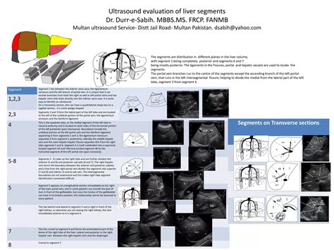 Liver Segments Infographic Pptx