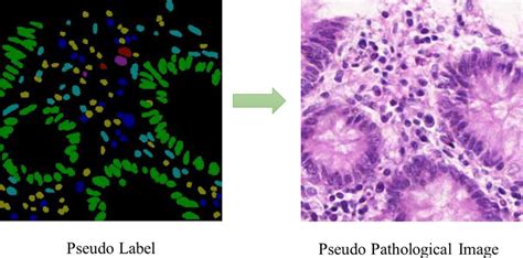 The Cases Of Generating Pseudo Pathological Images Using Pseudo Labels Download Scientific