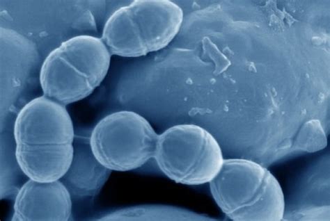 Protein Balance Of Lactococcus Lactis In Cheese Production Wur