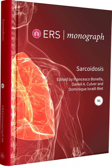 Ers Monograph 2022 Number 96 Sarcoidosis انتشارات سالکان