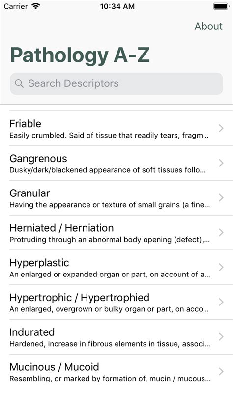 ios isplitviewcontroller can detailviewcontroller load data from