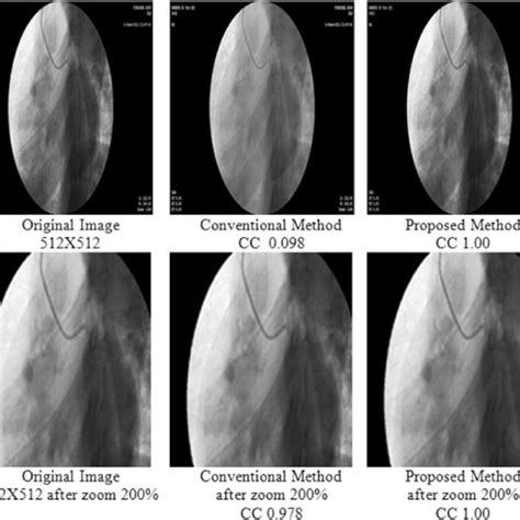 Comparison Of Conventional And Proposed Reconstruction Image Quality
