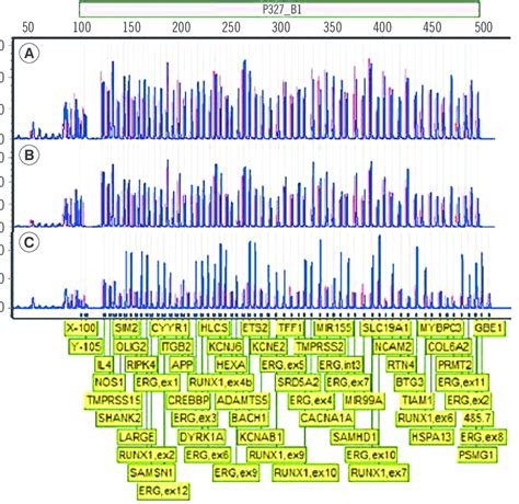 Multiplex Ligation Dependent Probe Amplification Analysis Of Three Download Scientific Diagram
