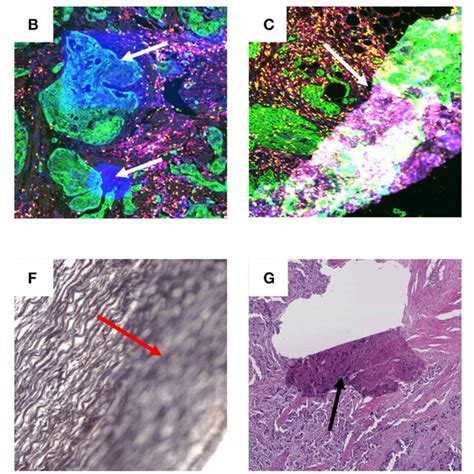 Examples Of Artifact In Both Fluorescence And Brightfield Captured