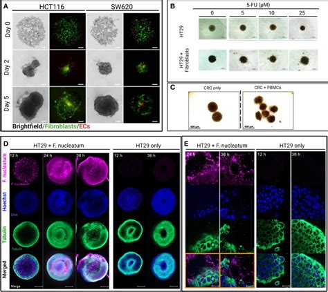 frontiers three dimensional heterotypic colorectal cancer spheroid