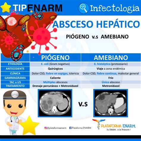Absceso HepÁtico 🩺 Medicina Humana Medicina De Urgencias Medicina