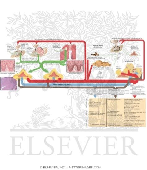 Cushing Syndrome Pathophysiology