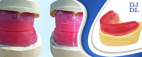 Bite Blocks Dave Johnson Dental Lab Removable Dentures