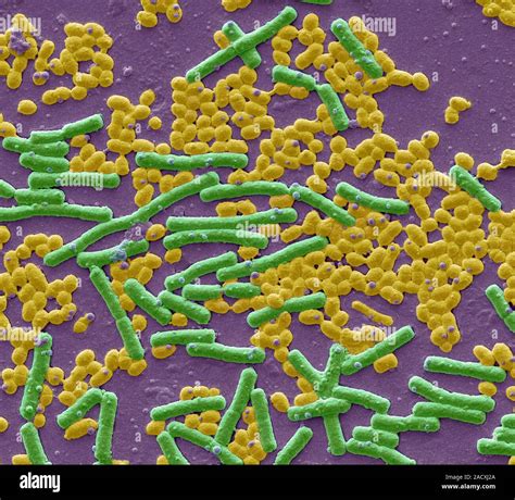 Haemolytic Streptococcus And E Coli Coloured Scanning Electron Micrograph Sem Streptococci
