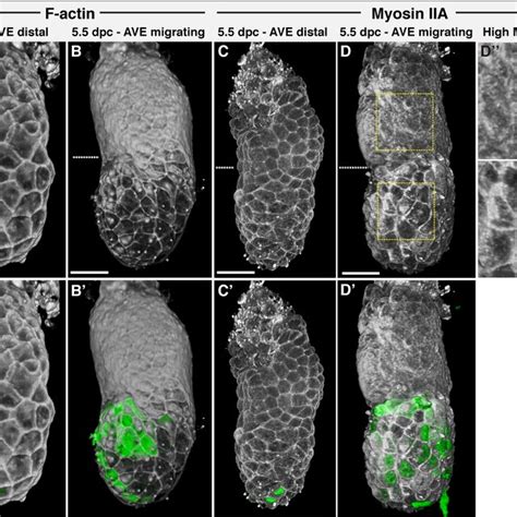 F Actin And Myosin Iia Localisation At Different Stages Of Ave