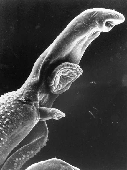 Fewer Infections More Allergies Finding The Connection